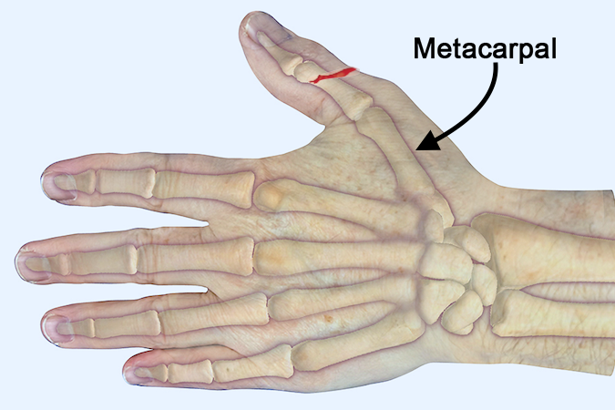 First Metacarpal Bones Exam Anatomic Structures At Risk